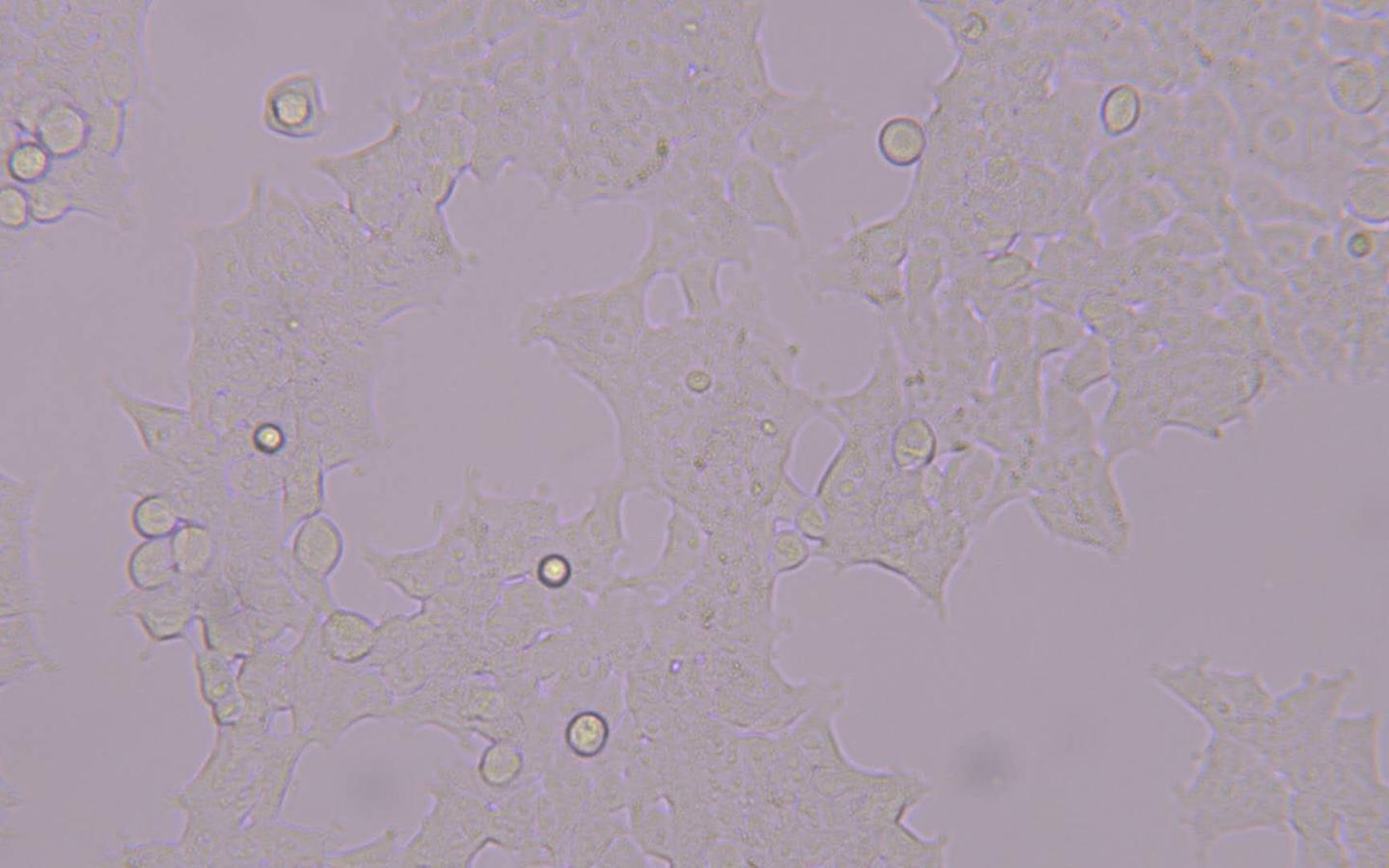 293T细胞在显微镜下的形态 - 知乎