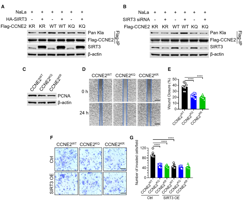 EMBO Rep | 中国科学技术大学王毅团队揭示CCNE2乳酸化修饰促进肝细胞癌进展的新机制 - 知乎