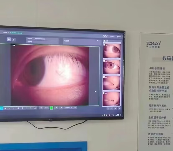 每天对着电脑十个小时的工作和学习,怎么降低视疲劳呢? 知乎