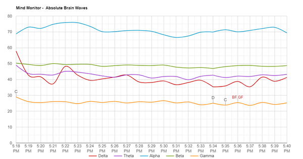 神经反馈设备使用感受2：采集Muse的EEG原始数据 - 知乎