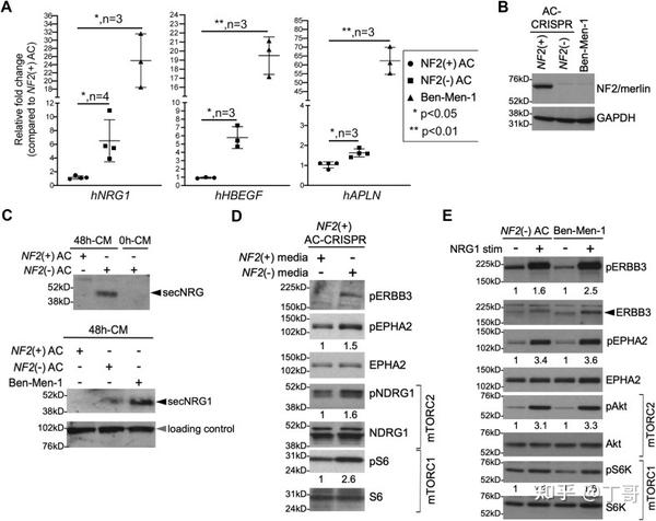 mTOR 激酶抑制破坏神经调节蛋白 1-ERBB3 自分泌信号并使NF2缺陷脑膜瘤细胞模型对 IGF1R 抑制敏感 - 知乎