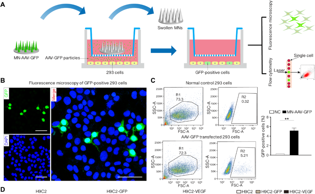 专家点评：微针介导的AAV基因疗法治疗心肌病，实现高效递送、均匀分布 - 知乎