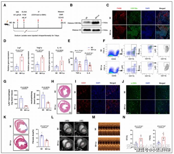 组蛋白乳酸化修饰在心血管疾病中的调控研究，看这篇23+文章如何展开 - 知乎