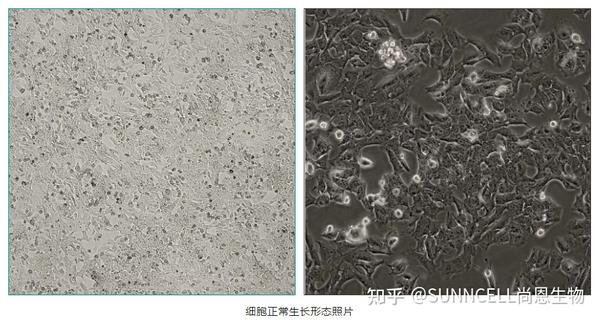 细胞攻略 | GL261(小鼠胶质瘤细胞)培养教程 - 知乎