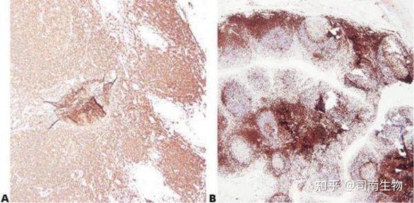 IHC 染色实践指南 - 知乎