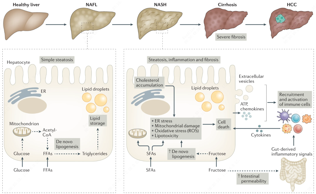 NucleoPro｜无药可治的NASH能否被小核酸药物攻克？ - 知乎
