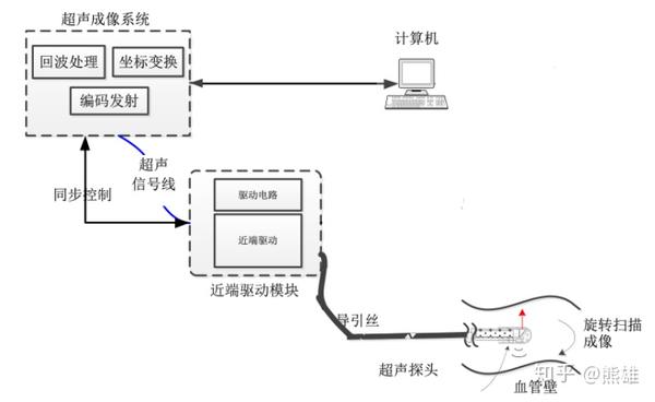 血管内超声（IVUS）概述（一） - 知乎
