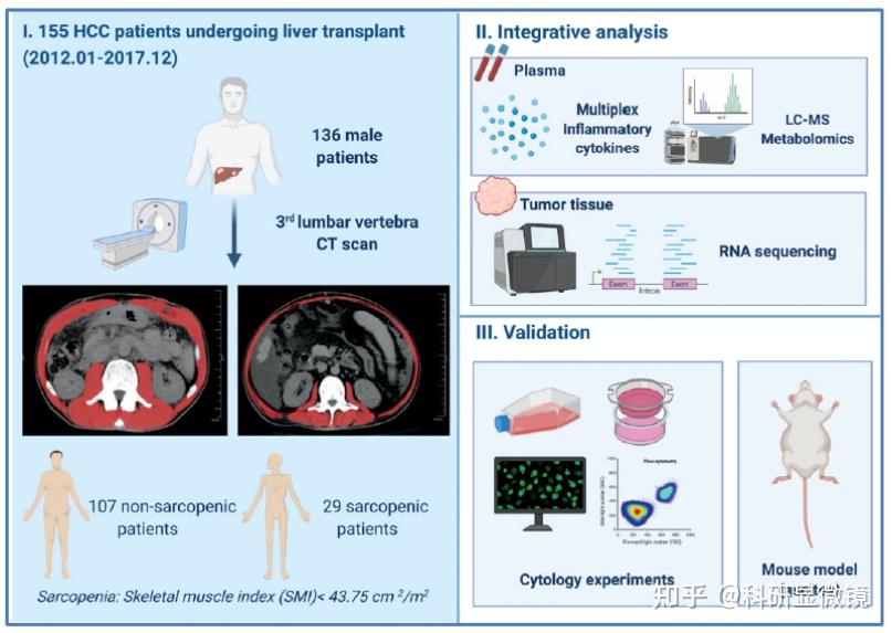 10sci案例解读之:多组学整合分析联合机制研究 知乎