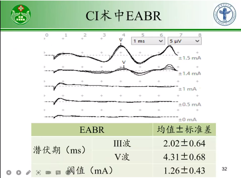 临床听力学技术专业沙龙｜人工耳蜗植入术中及术后EABR的应用 - 知乎