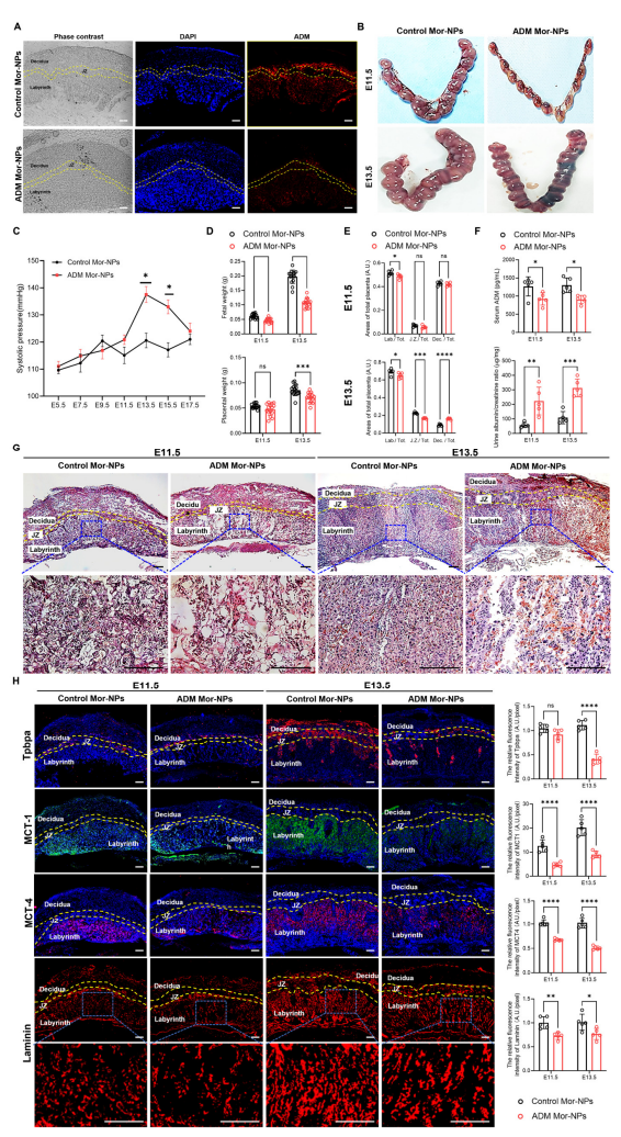 Sci. Adv. | Stereo-seq揭示肾上腺髓质素在胎盘发育和早发型子痫前期发病机制中的作用 - 知乎