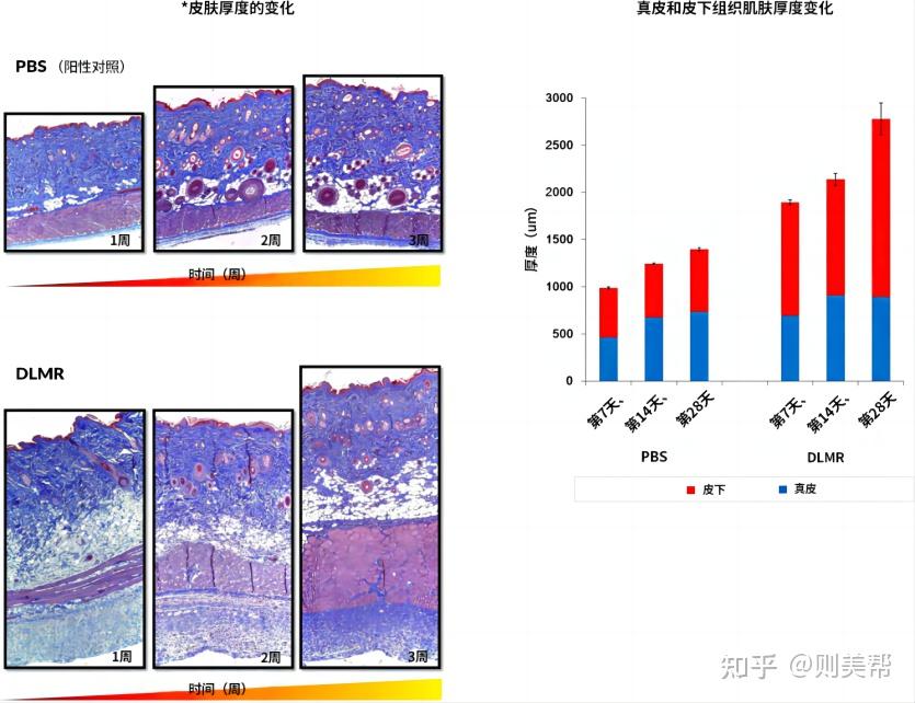 八点提升--新一代轮廓提升方案 - 知乎
