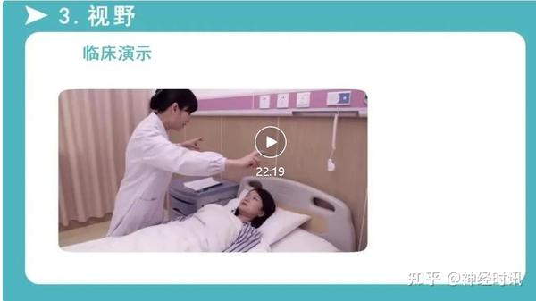 NIHSS评分解析及视频，看看你用对了吗？ - 知乎