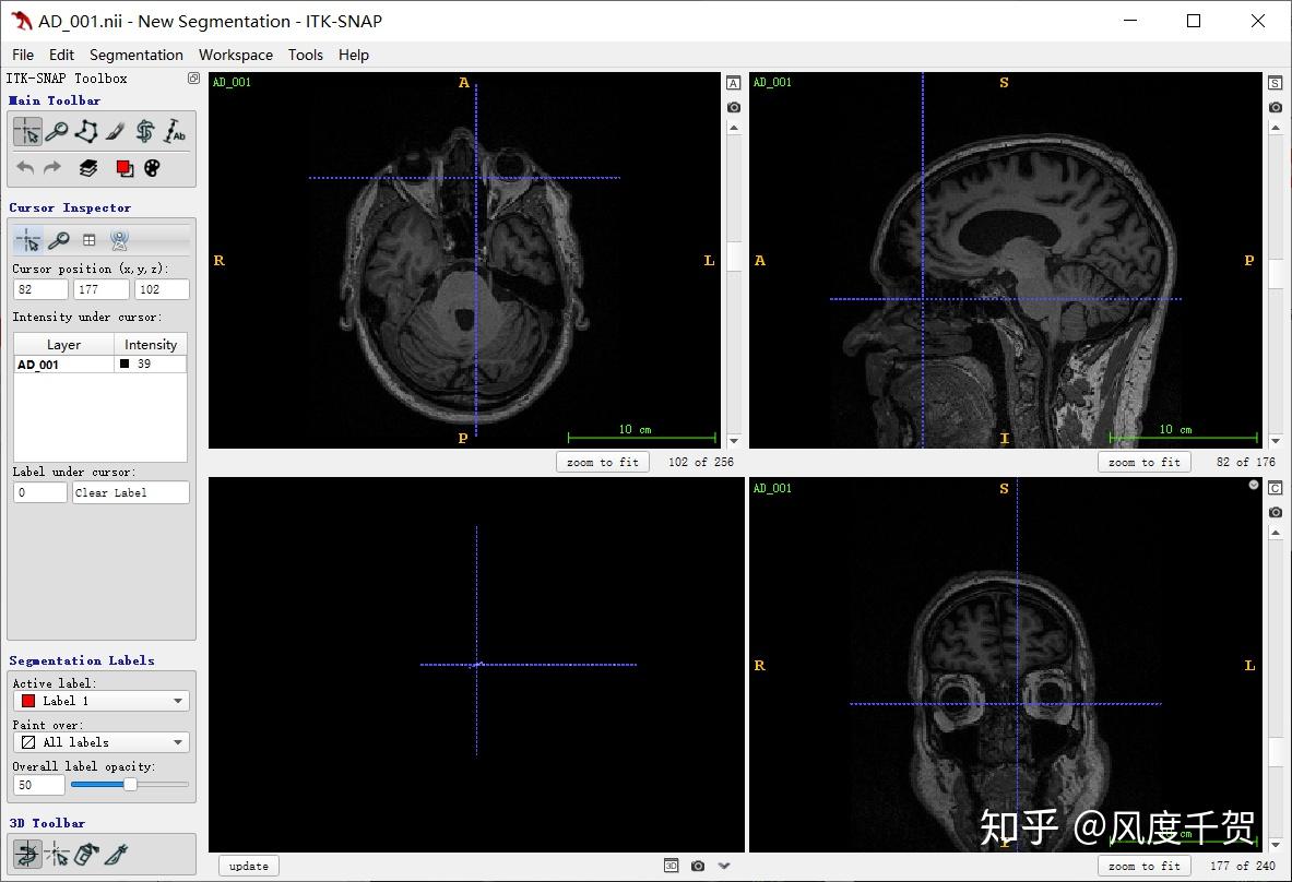 医学影像图片格式 - 知乎