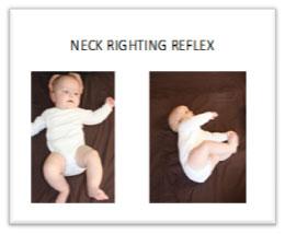 儿康笔记——立直反射检查 - 知乎