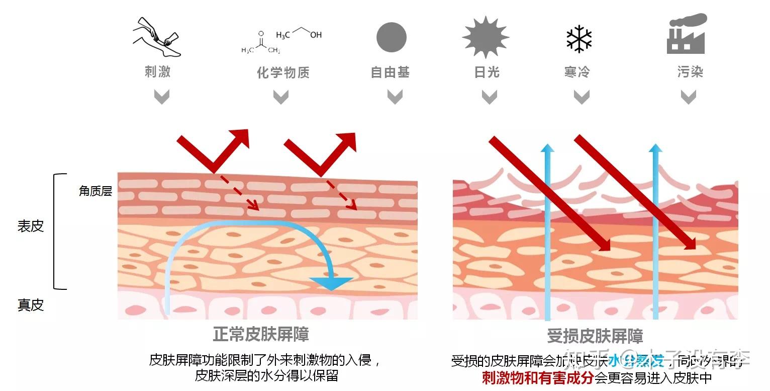 男生如何在1个月内快速祛痘?怎么做才能不反复?皮肤科医生教你最详细的男士祛痘攻略,0基础小白包学会! 知乎