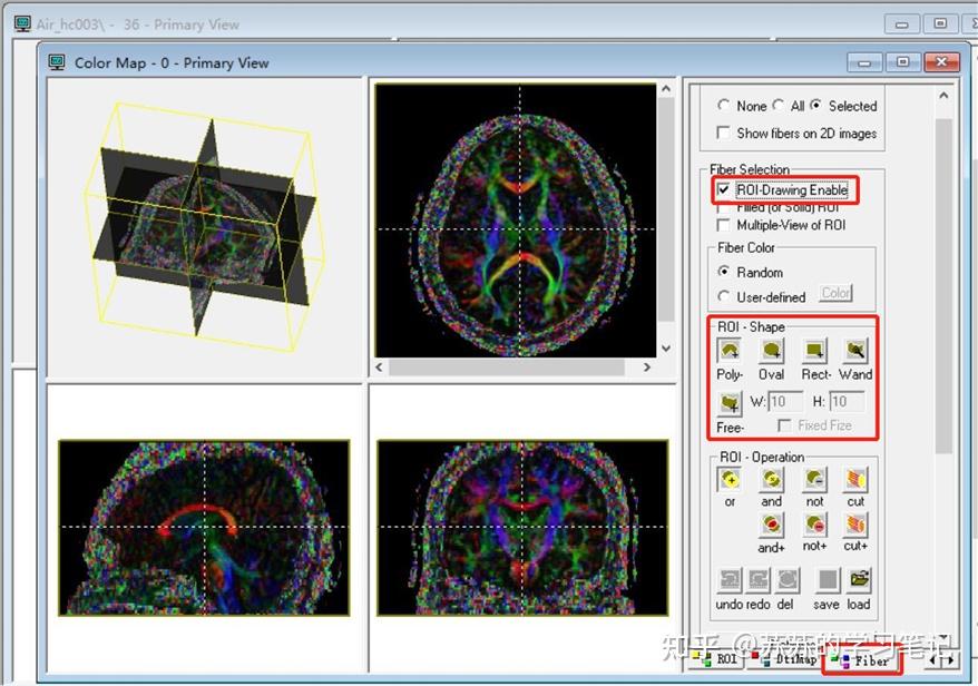 DTI Studio操作教程 - 知乎