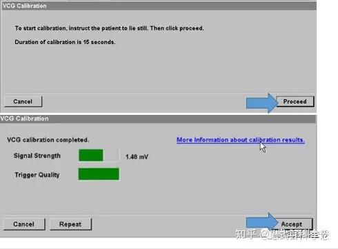心脏磁共振技术大全（一） - 知乎