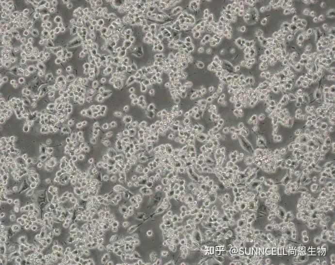 Neuro-2a(小鼠脑神经瘤细胞)培养注意事项 - 知乎