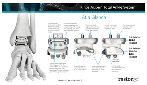 restor3d宣布首次使用3D打印全踝关节植入物Kinos Axiom系统进行手术 - 知乎