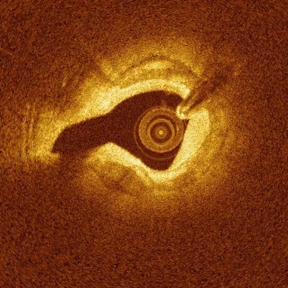 CCEC·前沿技术｜当人工智能“预见”OCT - 知乎