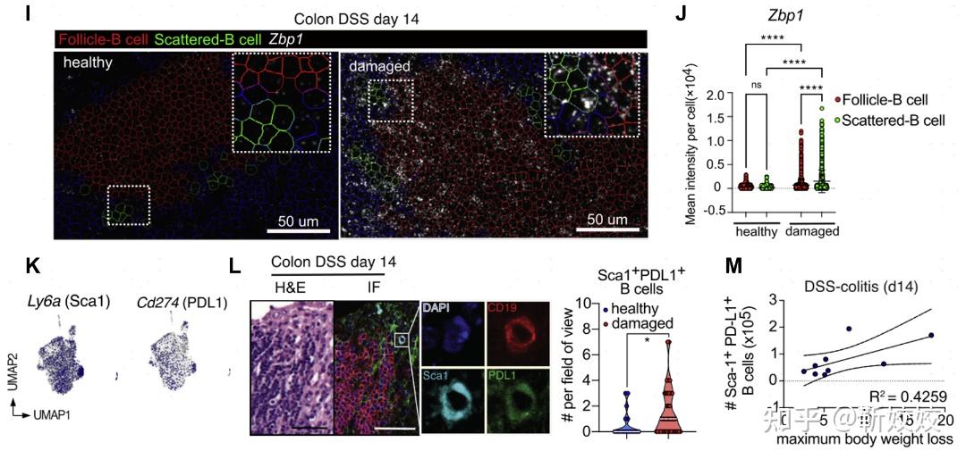 Cell子刊（IF=43）单细胞+空间多组学揭示B细胞可阻碍肠道修复 - 知乎