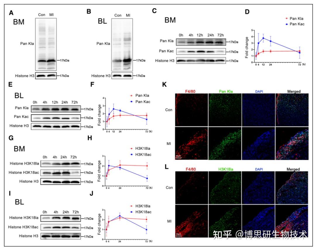 Circulation Research：组蛋白乳酸化促进心肌梗死后修复基因激活 - 知乎