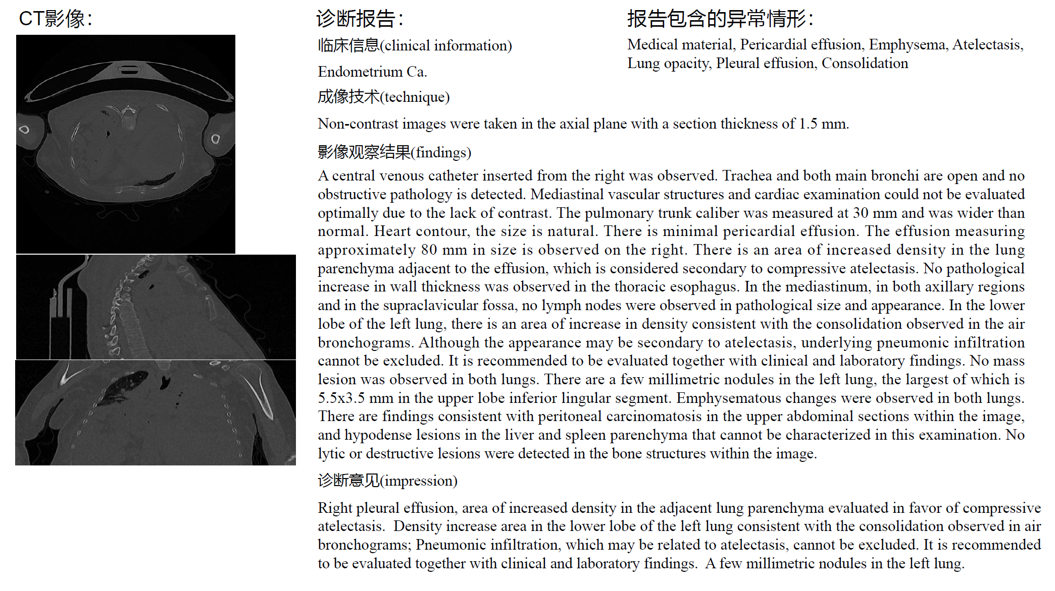 CT-RATE 胸部 CT 及其放射学诊断报告数据集介绍 - 知乎