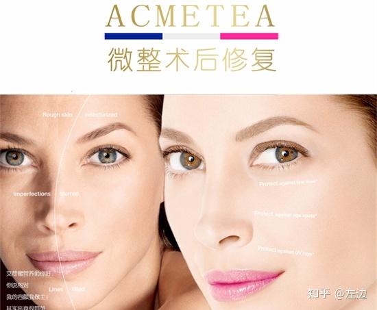 求实锤：拉皮手术几天拆线最好、拉皮手术恢复期多少天，口服ACME—TEA紧急修复 - 知乎