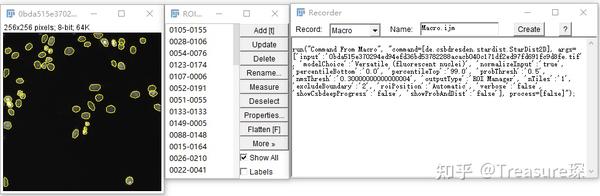ImageJ实用教程——StarDist批量细胞计数(案例分析篇) - 知乎