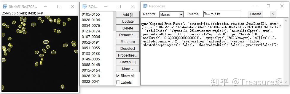 ImageJ实用教程——StarDist批量细胞计数(案例分析篇) - 知乎